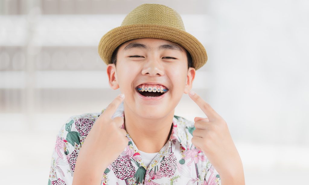 Veneers: Pioneering a New Era of Dental Minimalism – Elportal Dechari